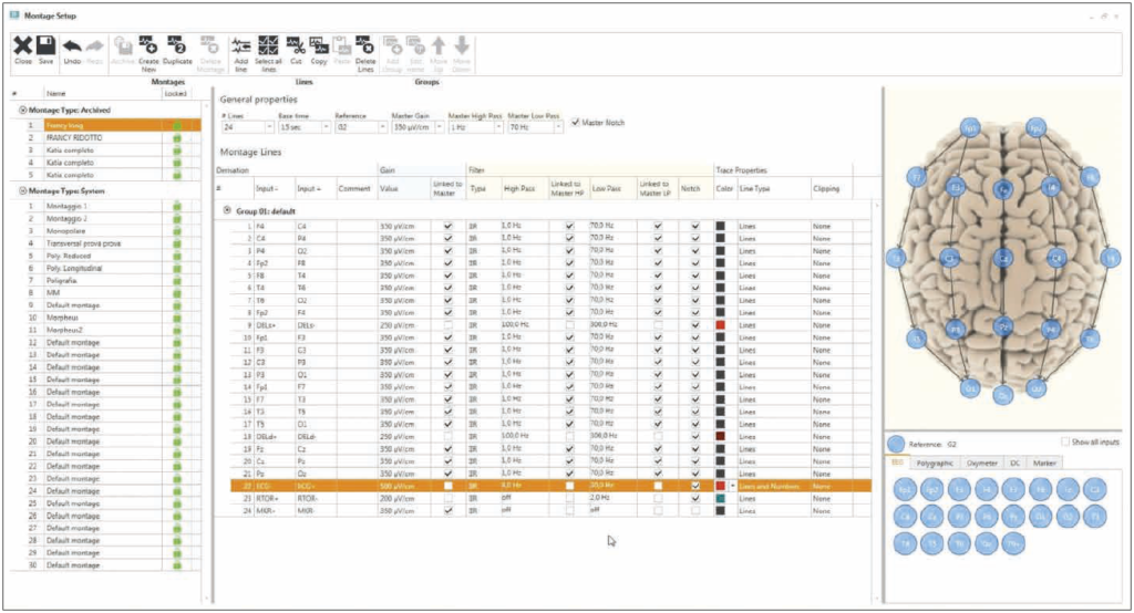 Micromed - Neurodata GmbH