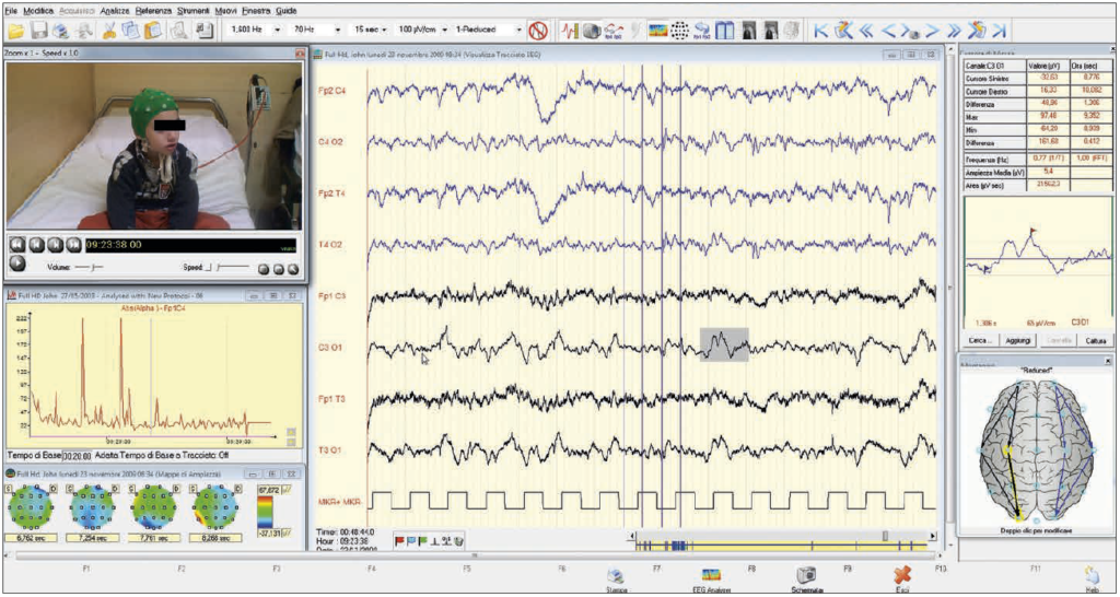Micromed - Neurodata GmbH