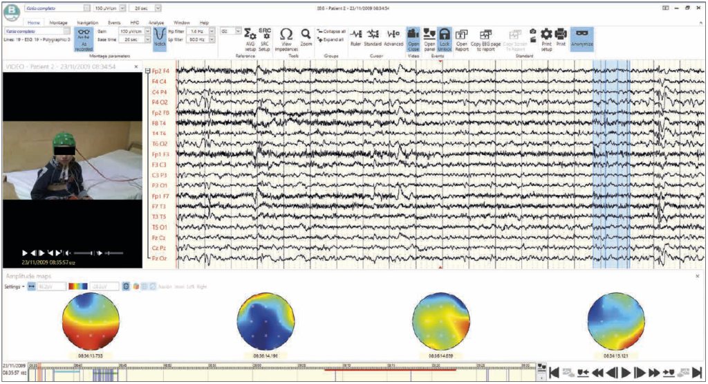 Micromed - Neurodata GmbH